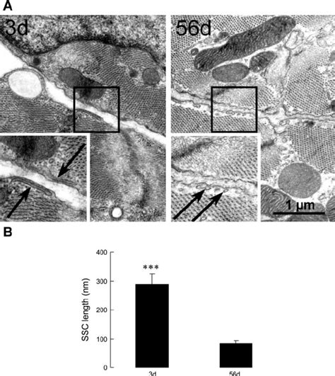 Cross Sectional Electron Photomicro Graphs Of Subsarcolemmal Cisternae Download Scientific