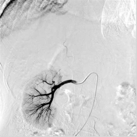 极光智能七轴平板dsa注册证 拍了拍你——双证加持 公司新闻 新闻中心 北京唯迈医疗科技股份有限公司 介入机器人领导者