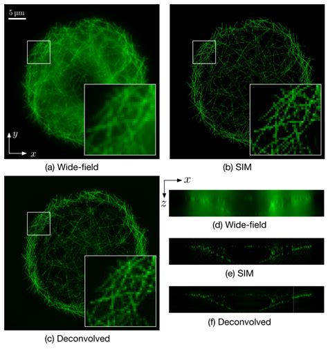 Comparison Of The Deconvolution Result And The Superresolution Sim