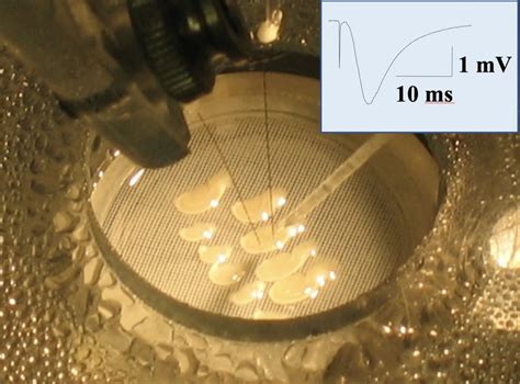 Hippocampal Brain Slices Are Pictured In A Recording Chamber Where The