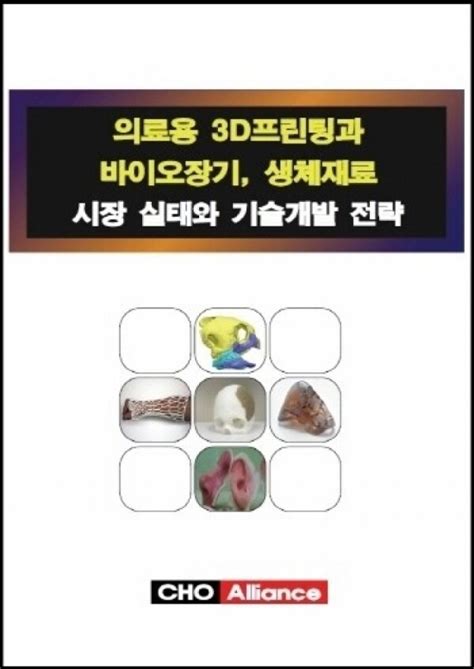 의료용 3d프린팅과 바이오장기 생체재료 시장 실태와 기술개발 리서치컴퍼니