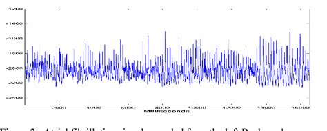 Figure 1 From Feature Extraction Of The Atrial Fibrillation Signal Using The Continuous Wavelet