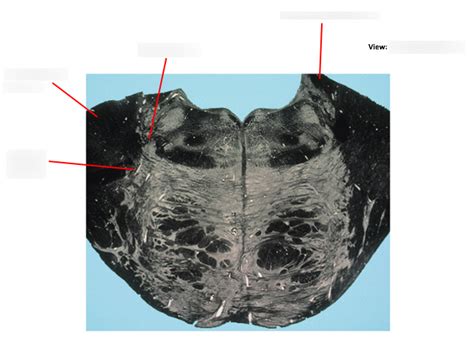 Neuroanatomy 2 Diagram Quizlet