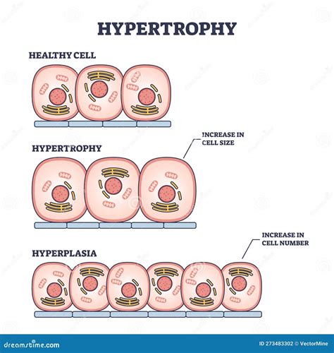 Hypertrophy Hyperplasia Or Healthy Muscular Cells Comparison Outline Diagram Stock Vector