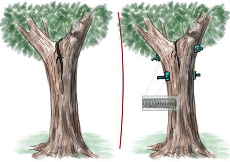 Cabling And Bracing Arbormax Tree Service