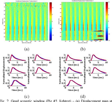 Figure 1 From Phase Aberration In Shear Wave Dispersion Ultrasound Vibrometry Semantic Scholar