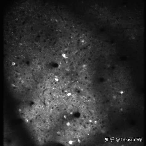 Matlab科研图像处理——互相关配准 知乎