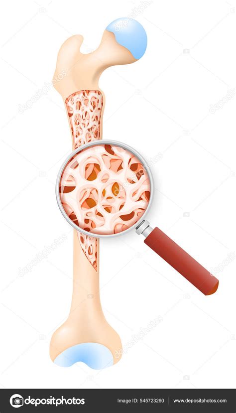 Density Healthy Bone Cross Section Human Femur Bone Showing Trabecular