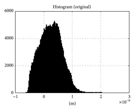 Histogram Equalization For A Typical Glioblastoma Multiforme Grade Iv Download Scientific