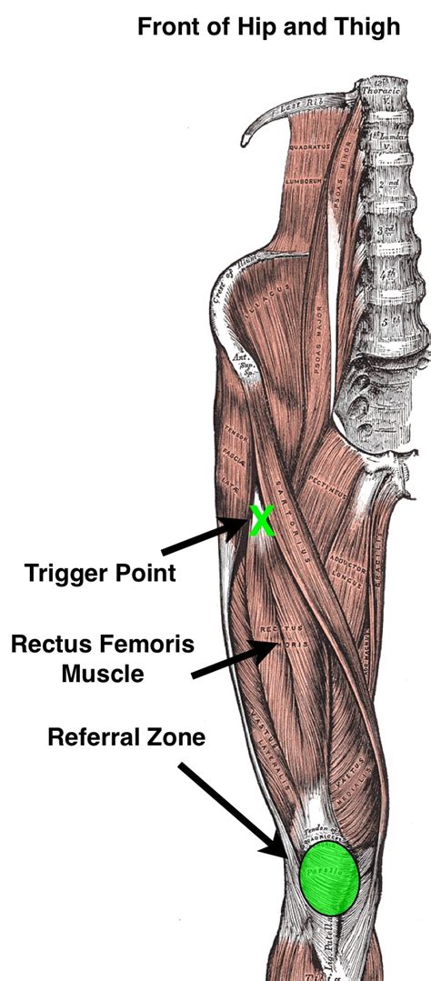 Trigger Points Part 3 Sharing The Health