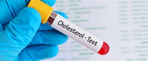 Cholesterol Testing A Deeper Look Vitamin G Nutraceuticals