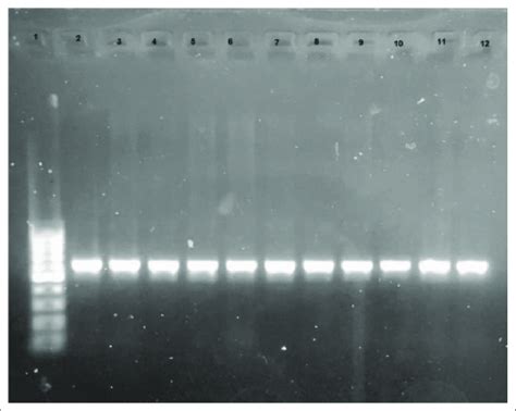 The Successful Pcr Amplification Lane 1 100 Bp Dna Ladder Lane 2