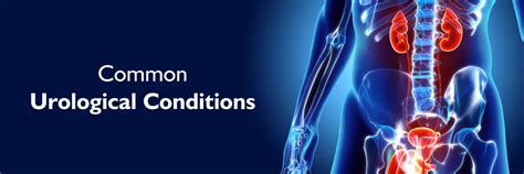 Urological Conditions Types Symptoms And Treatments
