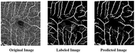 The Result Of Segmentation On Rose Dataset Download Scientific Diagram