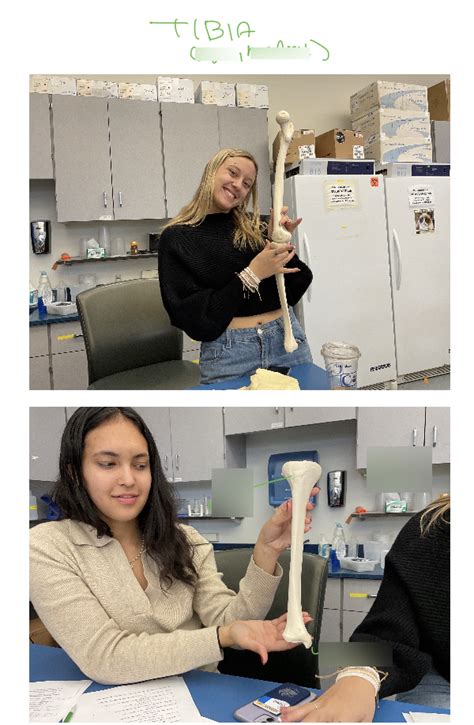 Tibia Pt 1 Diagram Quizlet