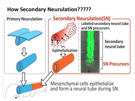 Secondary Neurulation
