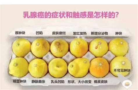 突然确诊癌症！00后姑娘惊了：不痛也不痒！医生：洗澡时这个细节太重要 小陈 检查 乳房