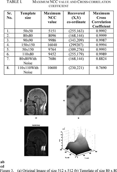 Figure 1 From Image Registration By Template Matching Using Normalized Cross Correlation