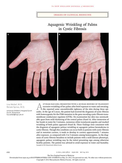 Pdf Aquagenic Wrinkling Of Palms In Cystic Fibrosis