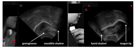 Visible Physical Landmarks Used To Maintain Ultrasound Probe Alignment Download Scientific