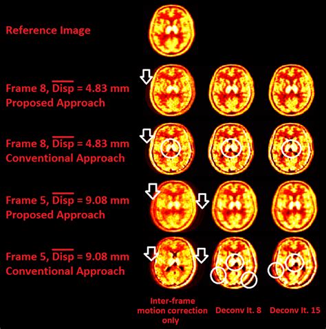 8 L To R Inter Frame Motion Compensated Images Inter Frame And Download Scientific Diagram