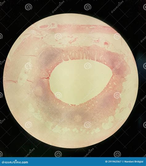 Cross Section Through A Human Appendix Royalty Free Stock Photography CartoonDealer Com