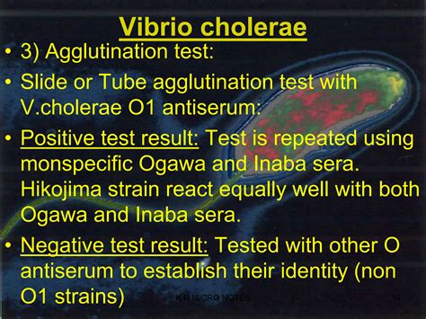 Vibrio Cholera Ppt