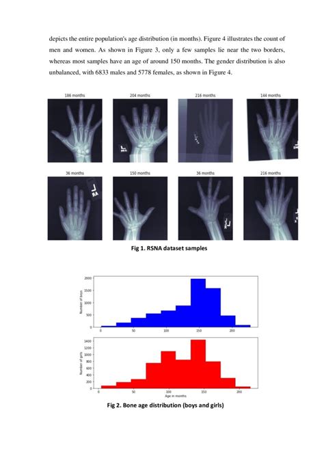 Pediatric Bone Age Assessment Using Deep Learning Models Deepai
