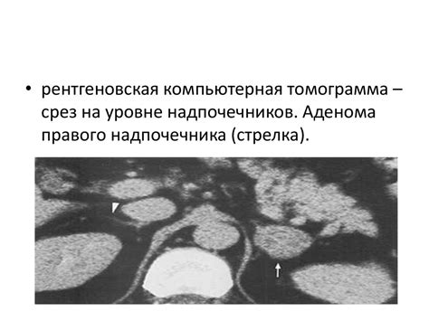 Лучевая диагностика заболеваний и повреждений эндокринной системы презентация онлайн