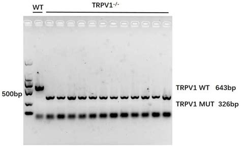 Trpv1在筛选或制备预防、缓解和 或治疗肝脏疾病的药物中的应用的制作方法 2