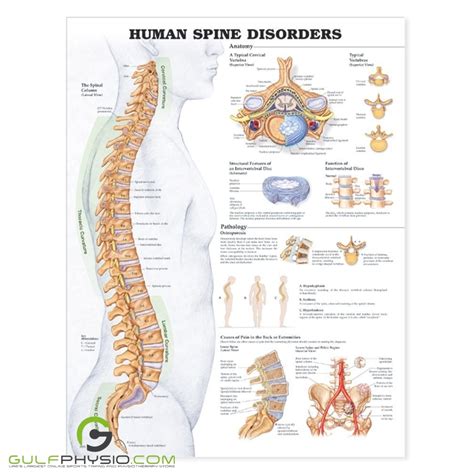 The Human Spine Disorders Chart Gulfphysio Uaes Online Physiotherapy Store
