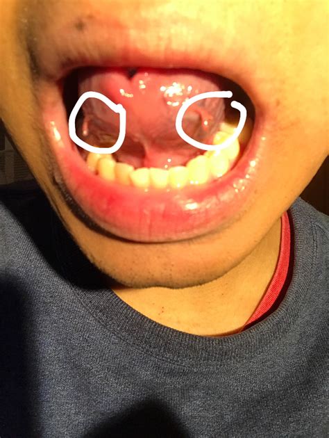 Hpv R Std