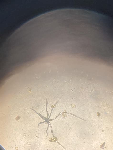 Does Anyone Know What This Is Found In A Fecal Float In A Shelter R