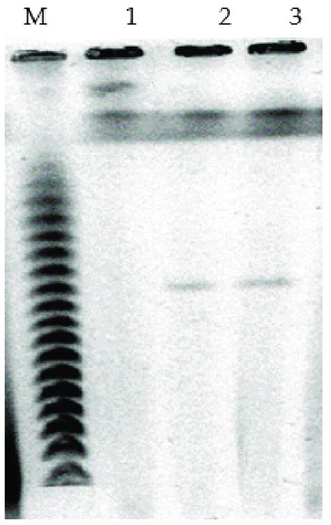 Electropherogram Of Plasmid Dna Of P Putida Strain Ch2 And P P Download Scientific Diagram