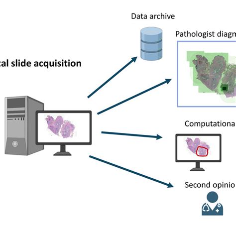 Hybrid Analog Digital Pathology Workflow With A Computer Assisted Download Scientific Diagram