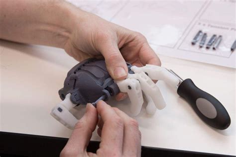 World First 3d Printed Hand Prosthesis Inspired By 1845 Design The