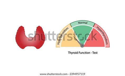 Thyroid Function Test Thyroid Gland Hypothyroidism Stock Vector