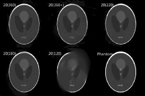 Five Types Of Few View Fan Beam Projection Data In Parallel Beam R θ Download Scientific