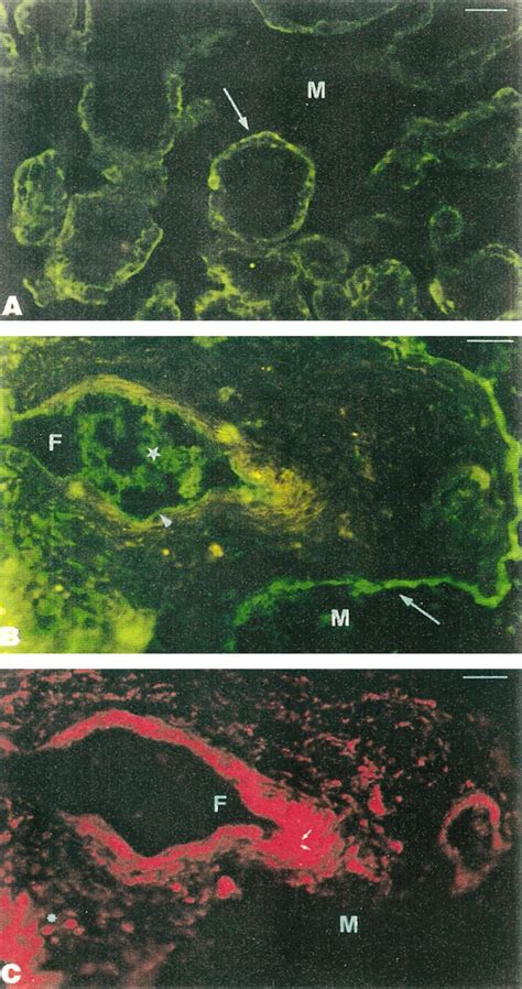 Immunohistochemical Localization Of Glut1 Glucose Transporter In Term