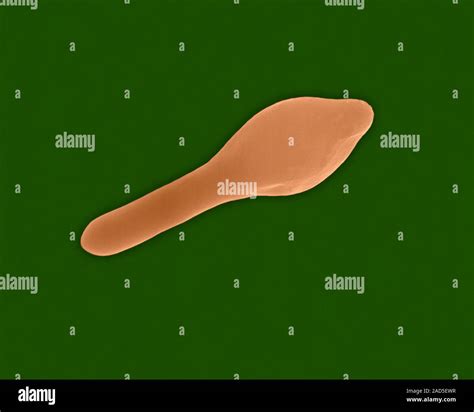 Coloured Scanning Electron Micrograph Sem Of Clostridium Botulinum Endospore Gram Positive