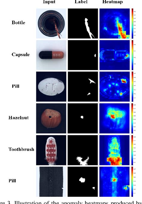 Figure 3 From Unsupervised Anomaly Detection And Localisation With Multi Scale Interpolated
