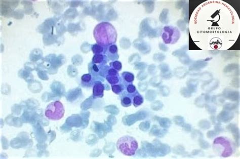 Sociedad Argentina De Hematología