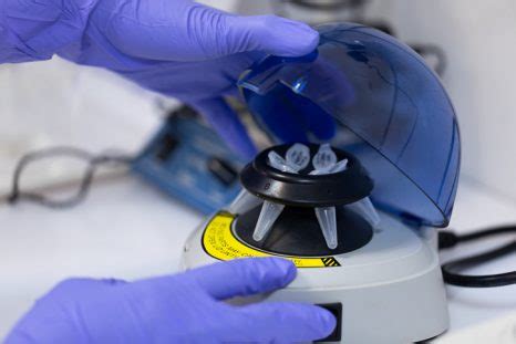 Authentication Of Human Cell Lines Through STR Profiling ANSI Blog