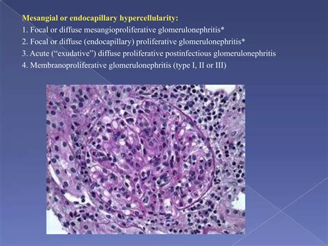 Interpretation Of Renal Biopsy Pptx