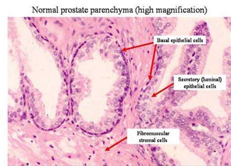 Prostate Applied Anatomy