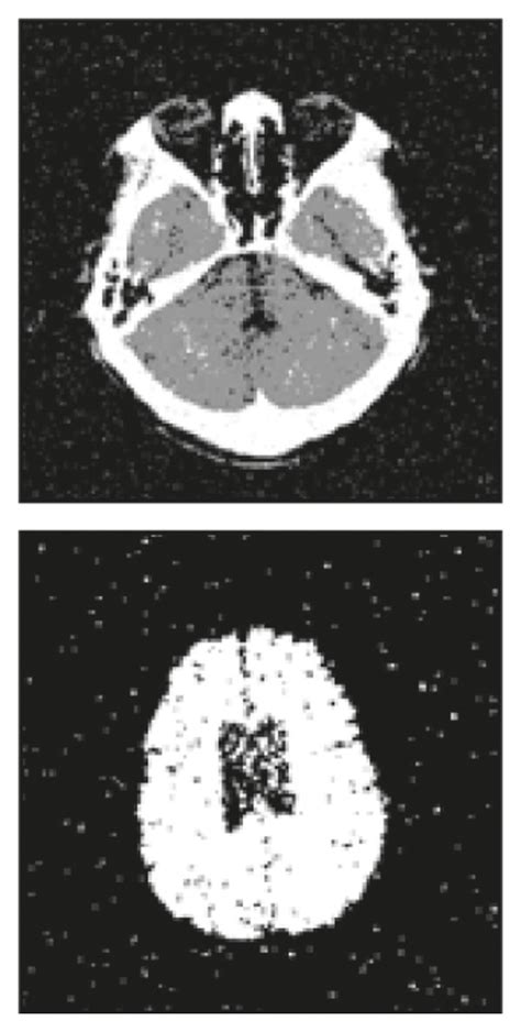 Different Segmentation Results Of Medical Images With Gaussian Noise