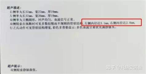老公得了精索静脉曲张会影响怀孕 怎么治 知乎