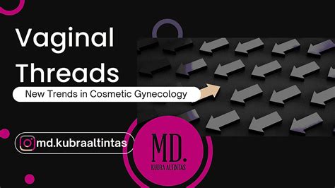Vaginal Threads Dr Kubra Altintas