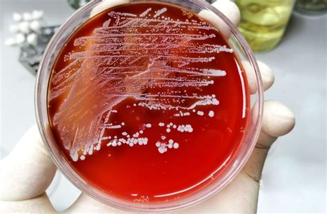 The Complexity Of Staphylococcus Aureus Its Role In Inflammatory Diseases And Emerging
