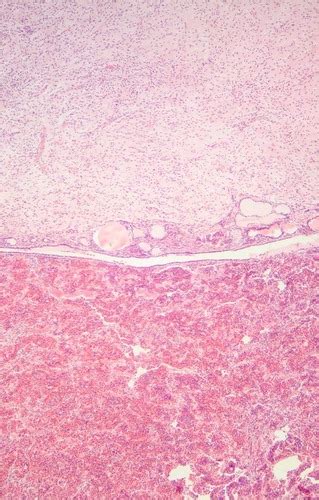 Lab 8 Senses And Endocrine System Flashcards Quizlet